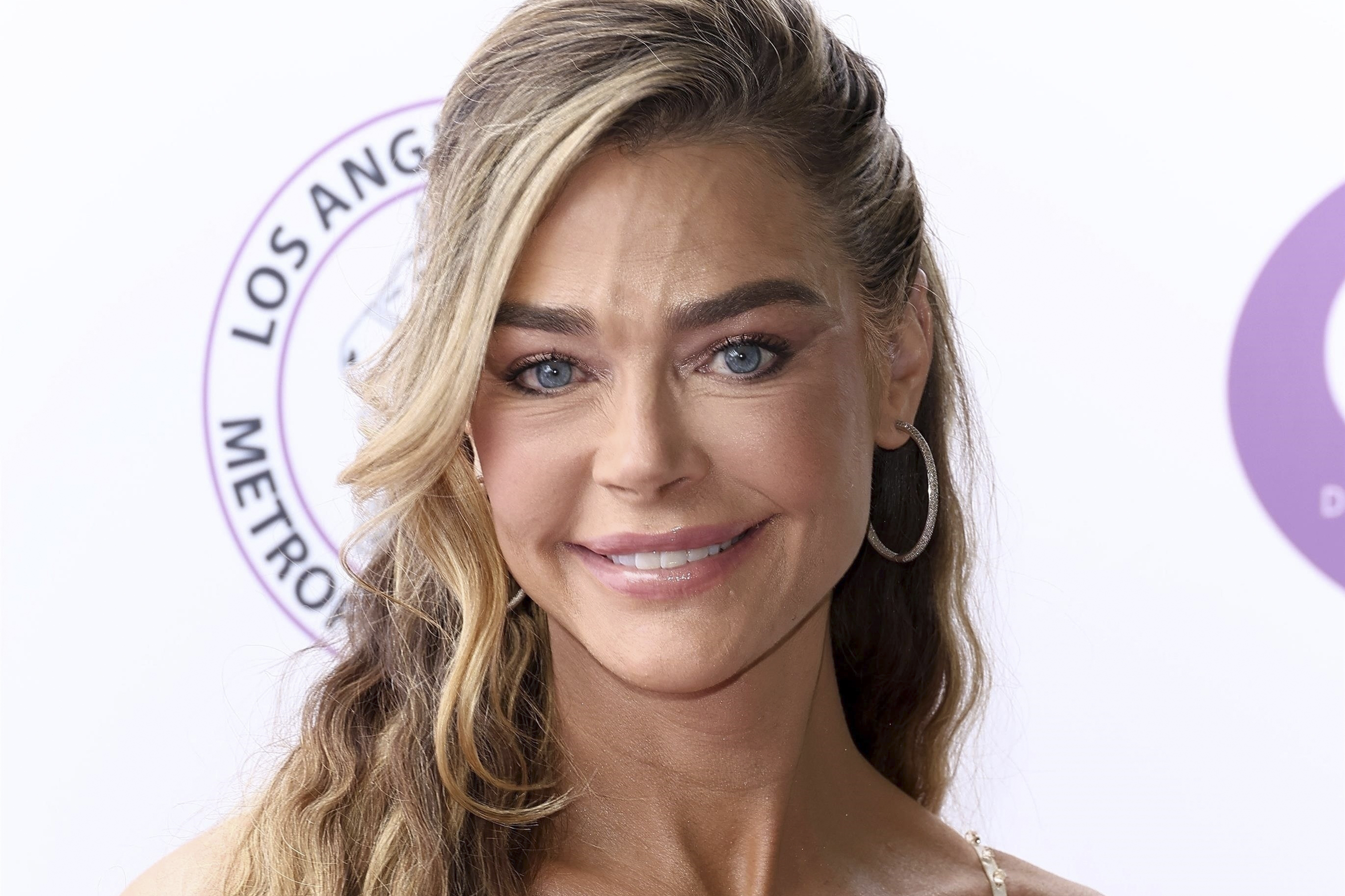 Denise Richards se somete a un impactante lifting facial y comparte las ...